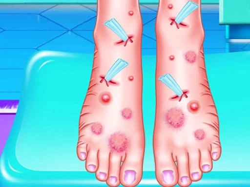 EMMA FOOT TREATMENT - Play EMMA FOOT TREATMENT on Humoq
